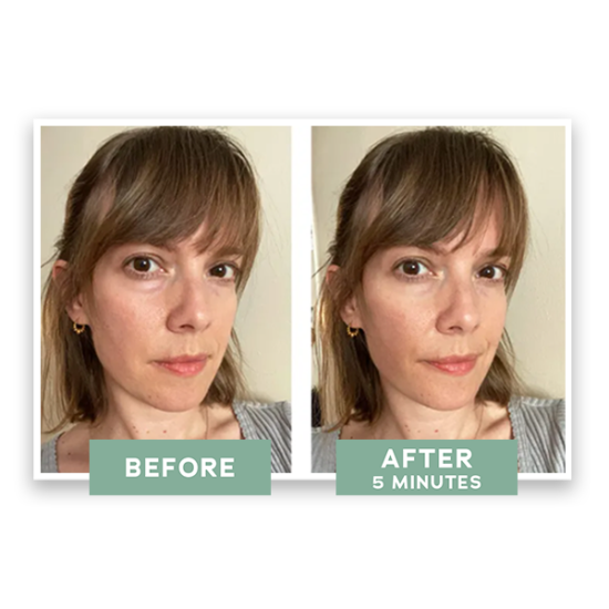 Park Perfection Instant Eye Lift | Recommended by In-Style and NY Mag