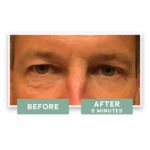 Park Perfection Instant Eye Lift | Recommended by In-Style and NY Mag