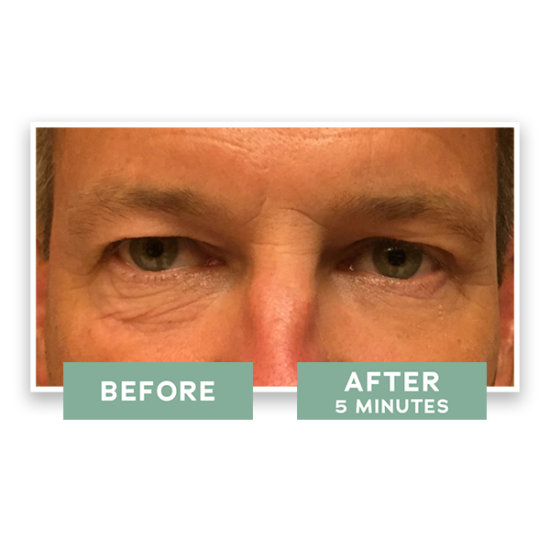 Park Perfection Instant Eye Lift | Recommended by In-Style and NY Mag