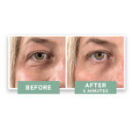 Park Perfection Instant Eye Lift | Recommended by In-Style and NY Mag